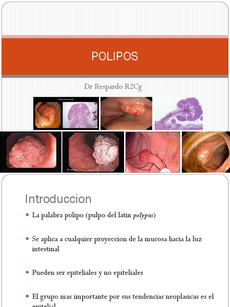 Clasificación y tipos de pólipos gastrointestinales | PDF | Cáncer ...