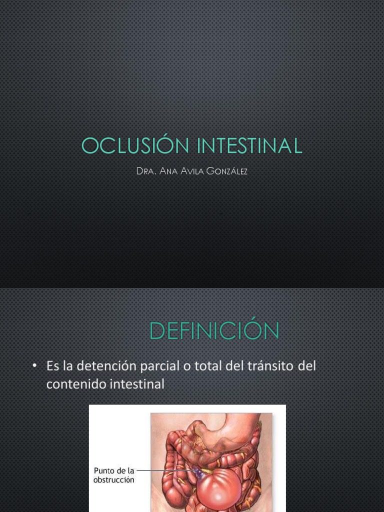 Oclusión Intestinal | PDF | Enfermedades digestivas | Medicina
