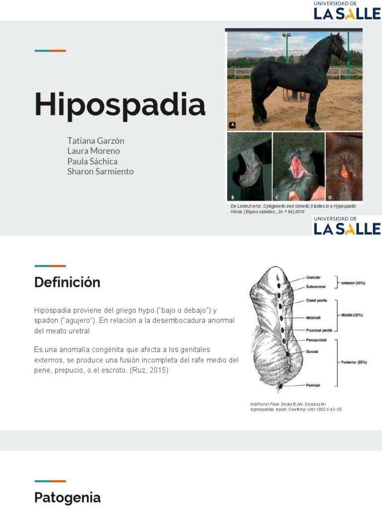 Hipospadia | PDF | Anatomia sexual | Sistema genitourinario