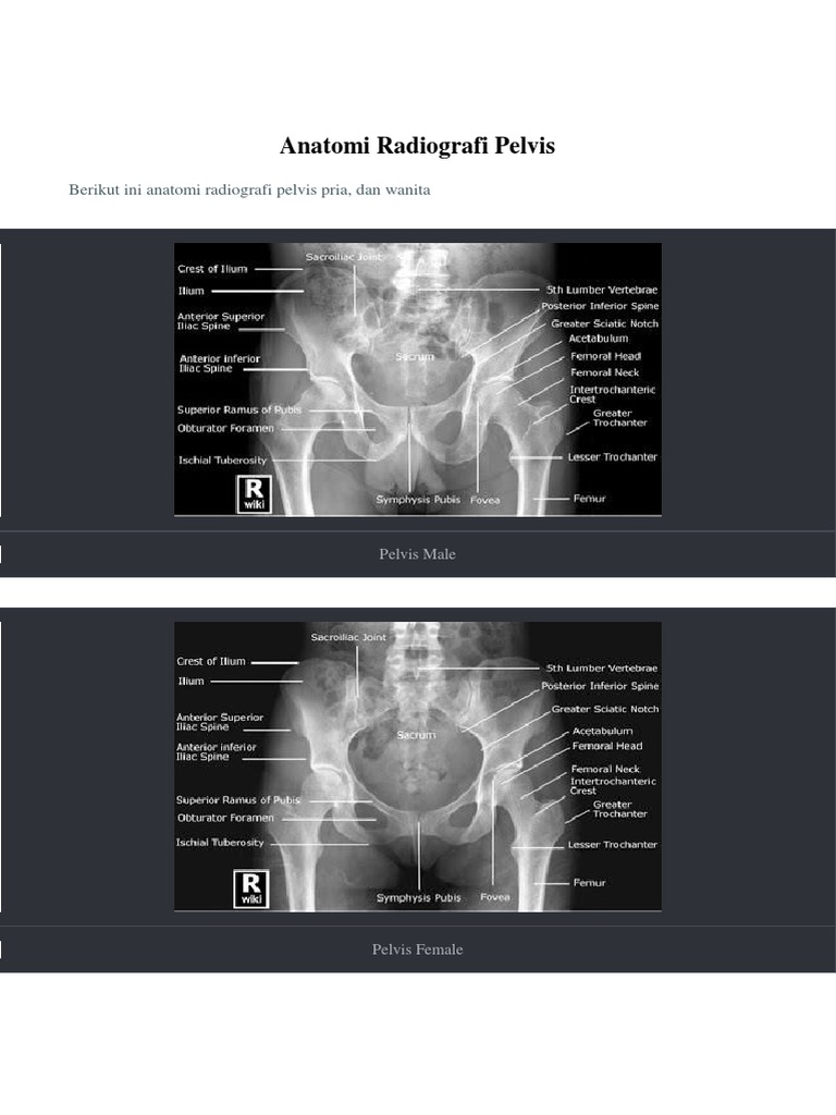 Anatomi Radiografi Pelvis Pria dan Wanita | PDF