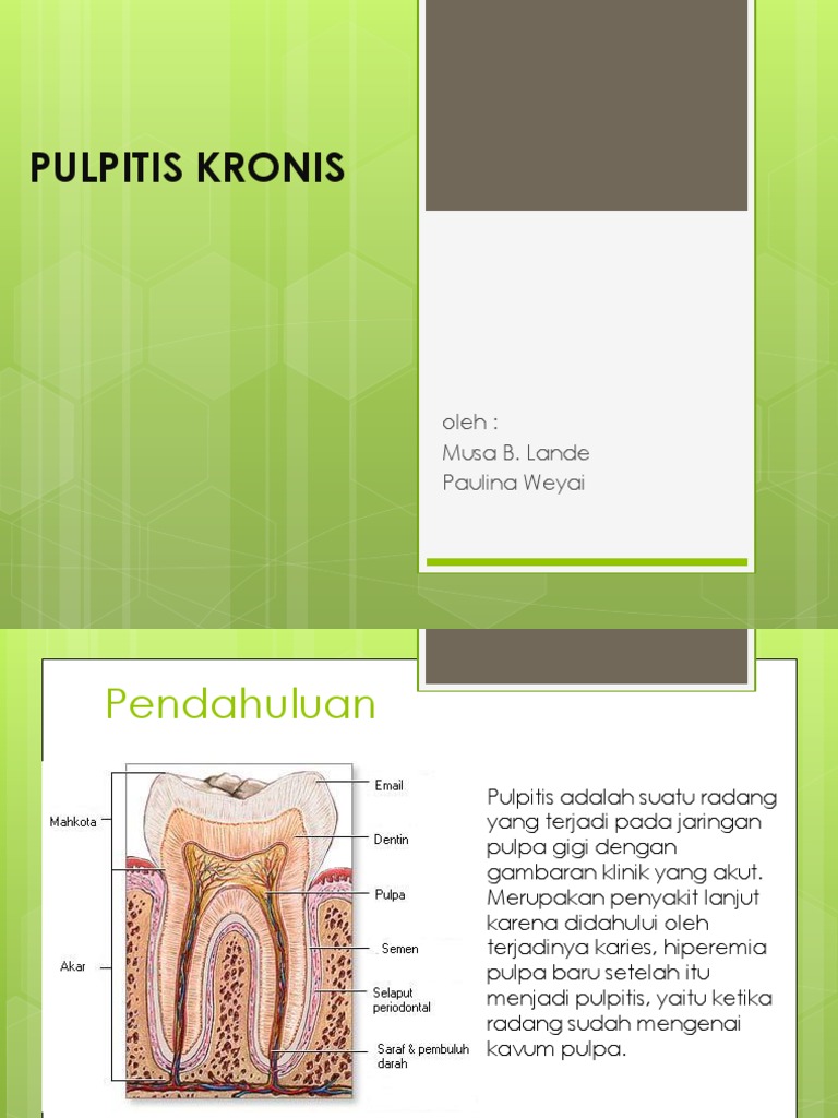 Pulpitis Kronis | PDF