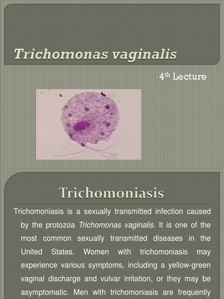 Trichomonas Vaginitis Discharge