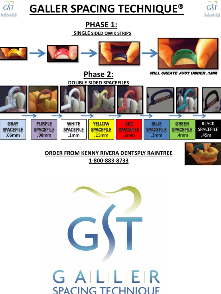 David Galler Spacing Technique | PDF