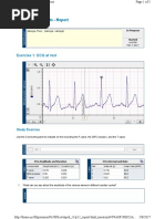 Left Anterior Fascicular Block (LAFB) - LITFL - ECG Library Diagnosis ...