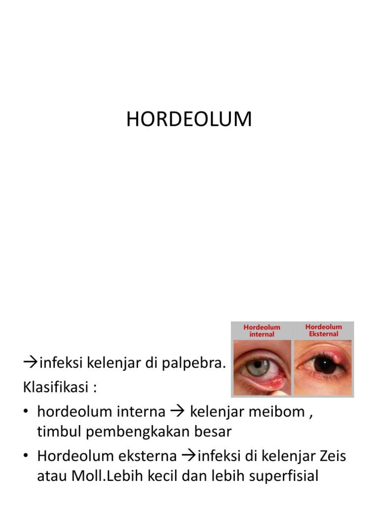 Horde Olum | PDF