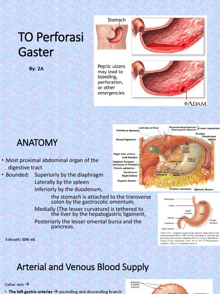 To Perforasi Gaster | PDF | Stomach | Organ (Anatomy)