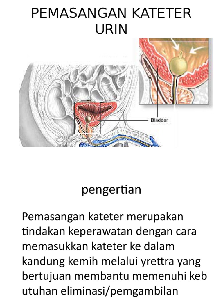 Pemasangan Kateter Urin | PDF