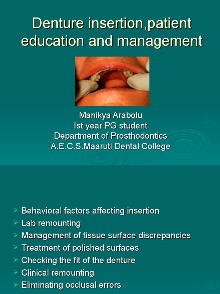 Denture Insertion, Patient Education and Management | PDF | Dentures ...