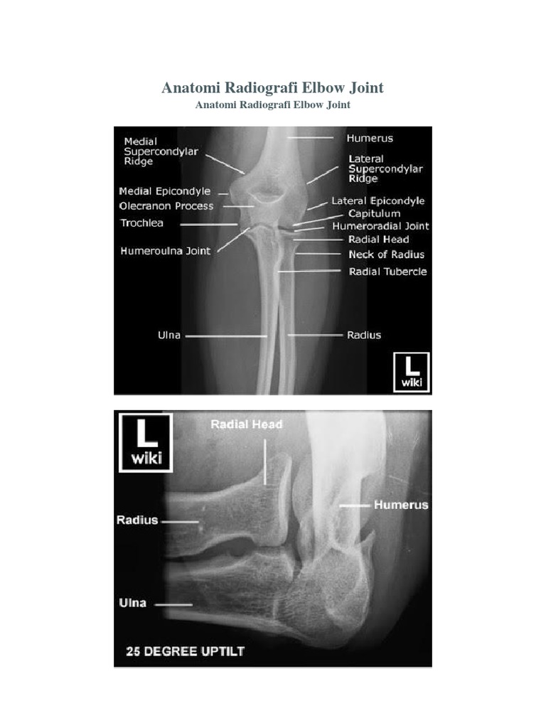 Anatomi Radiografi Elbow Joint | PDF