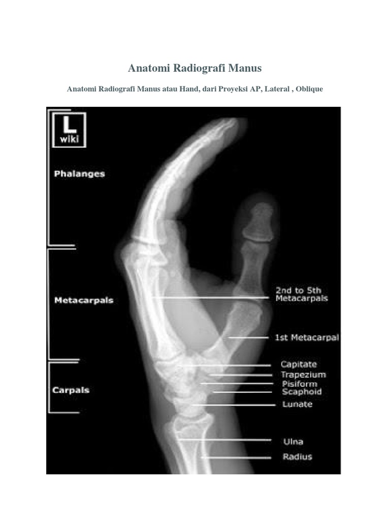 Anatomi Radiografi Manus | PDF