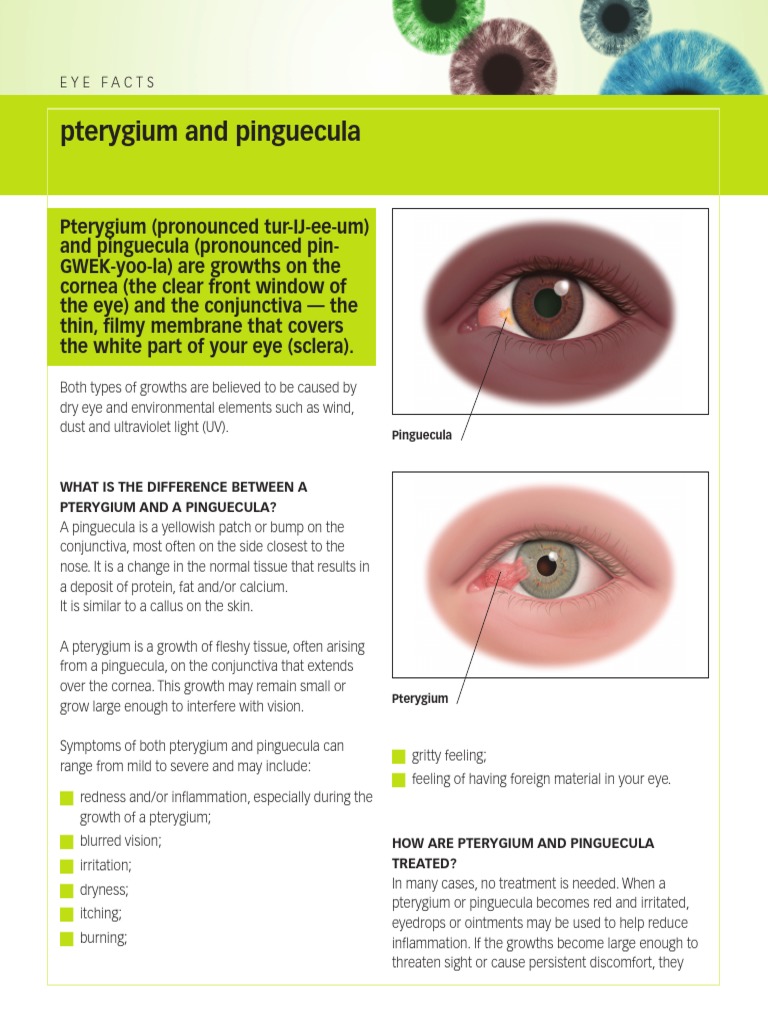 What Is The Difference Between A Pterygium and A Pinguecula? | Download ...