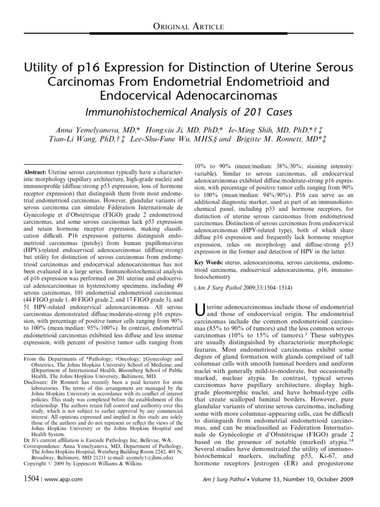 Utility of p16 Expression For Distinction of Uterine Serous Carcinomas ...
