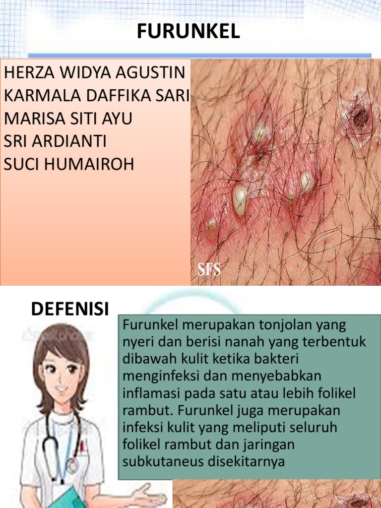 FURUNKEL | PDF | Pengembangan Diri