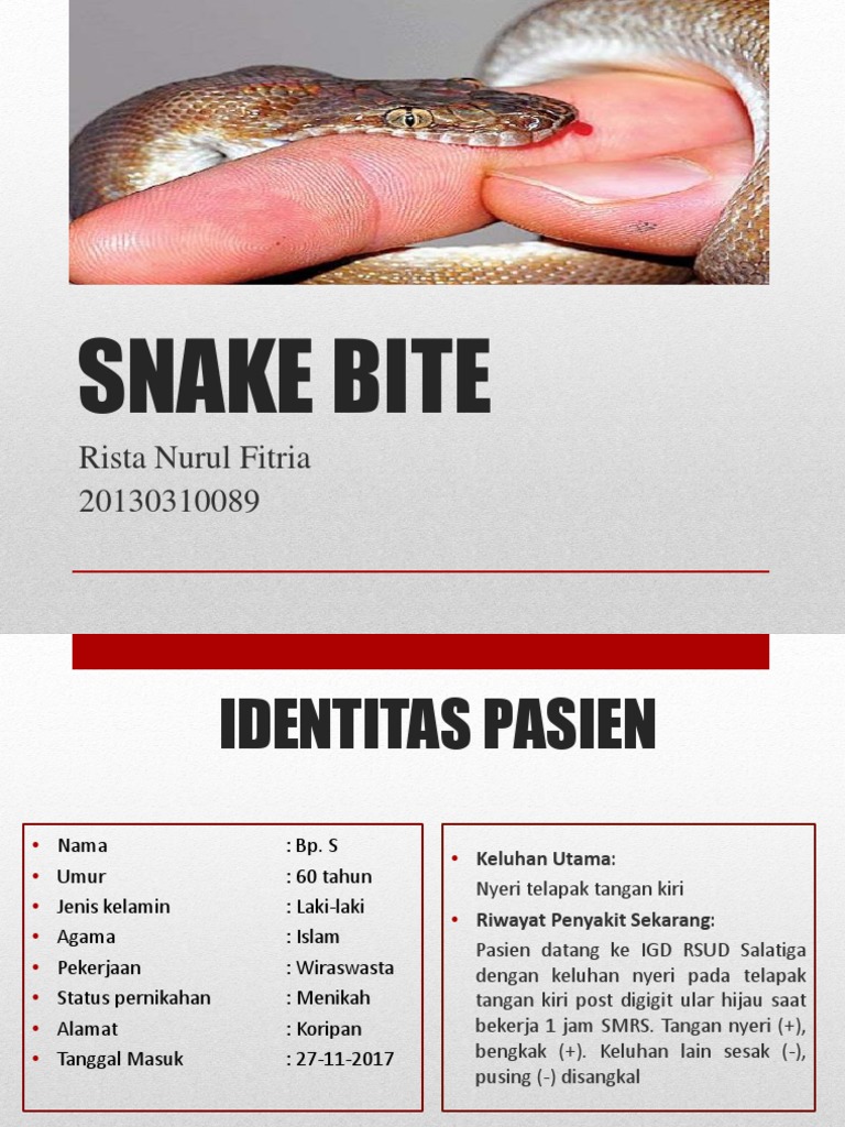 Snake Bite | PDF