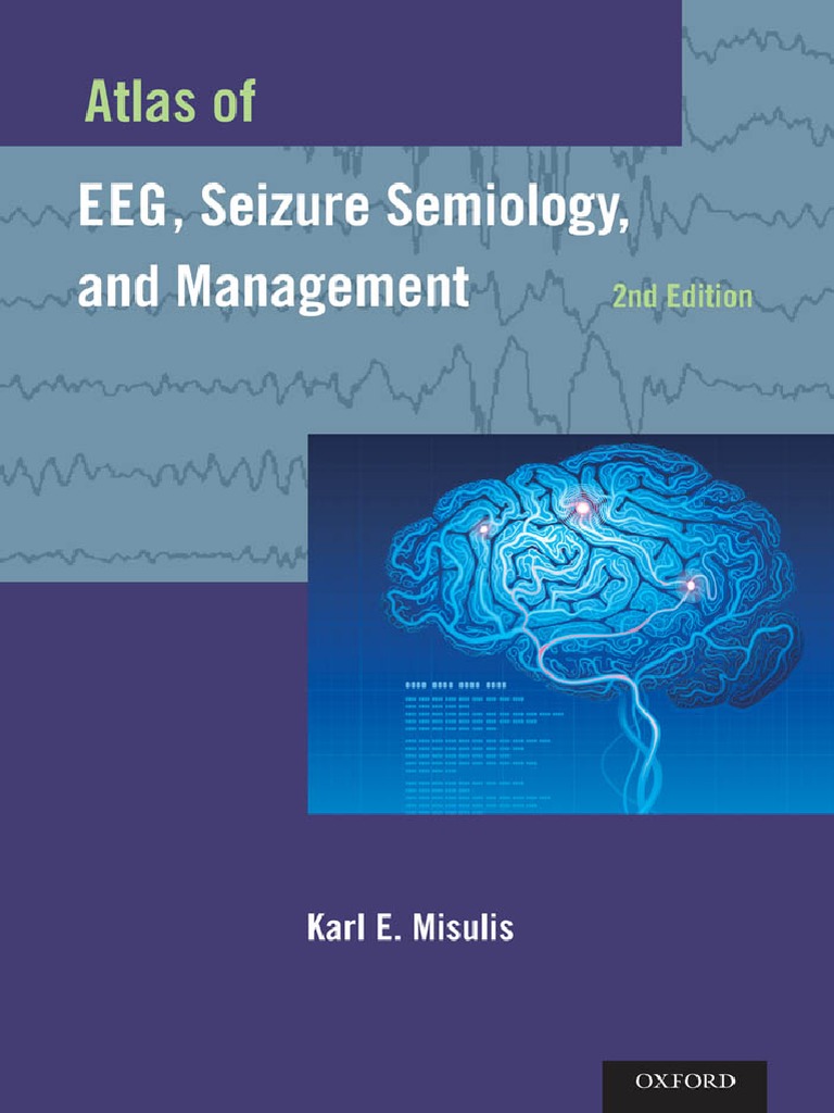 Atlas of EEG, Seizure Semiology, And Management 2nd Ed | Depolarization ...