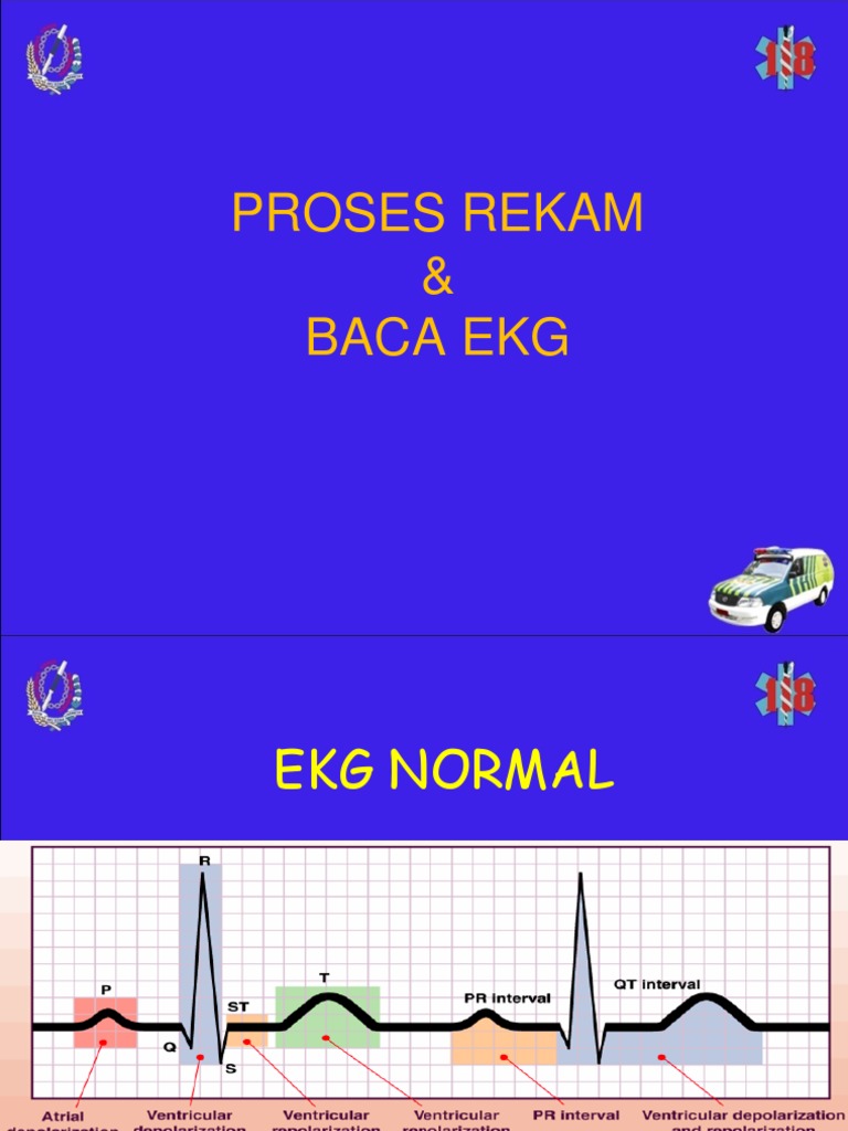 Panduan Lengkap Membaca EKG | PDF