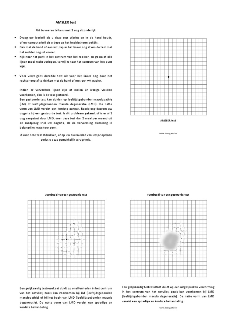 Amsler Test | PDF