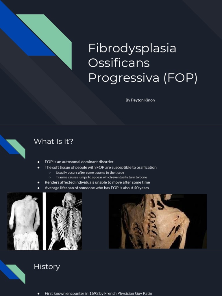 Fibrodysplasia Ossificans Progressiva | PDF | Human Diseases And ...