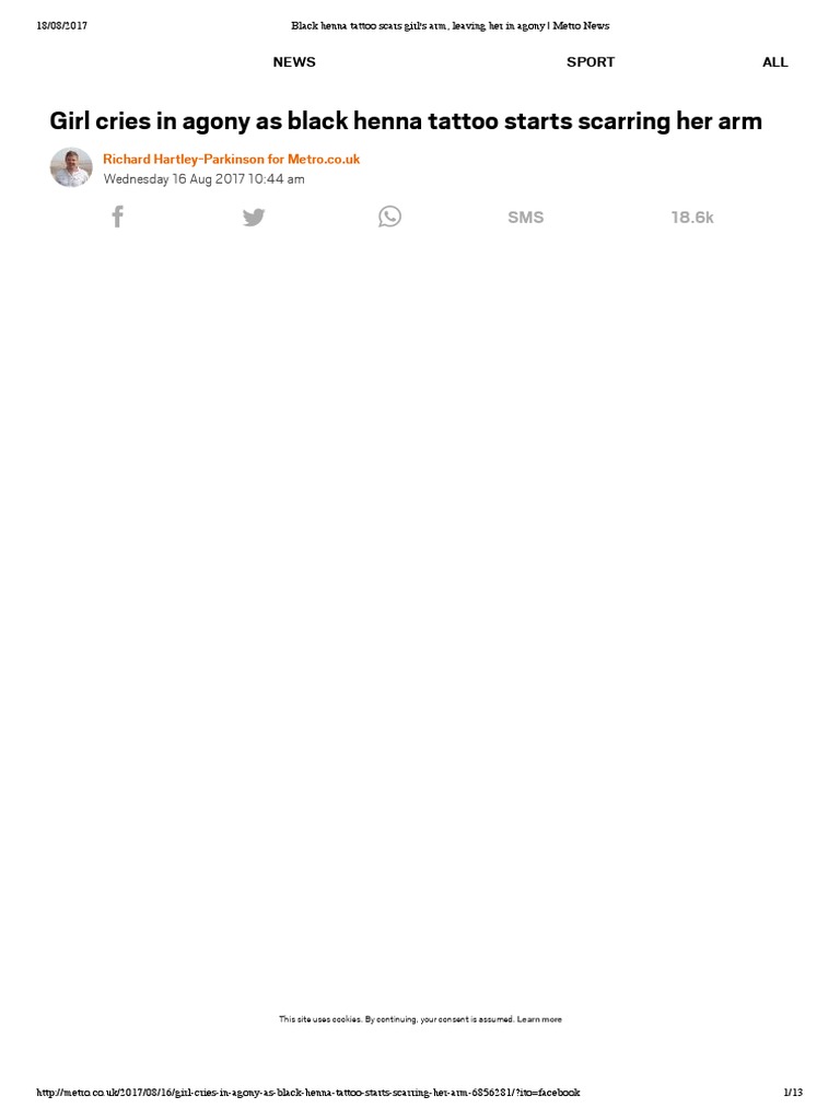 Black Henna Tattoo Scars Girl's Arm, Leaving Her in Agony - Metro News ...