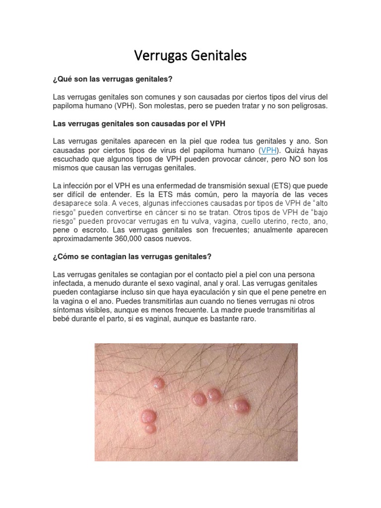 Información sobre verrugas genitales VPH | PDF | Ciencias sociales ...