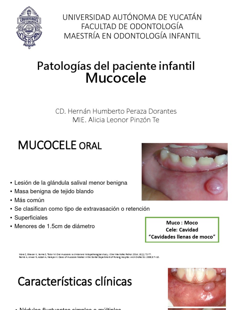Mucocele Expo | Boca | Especialidades Medicas
