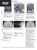 AOFAS Ankle Hindfoot Scale.d5404138 | PDF | Anatomical Terms Of Motion ...