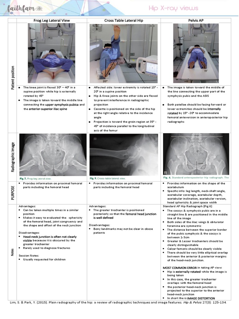 Cross Table Lateral X Ray