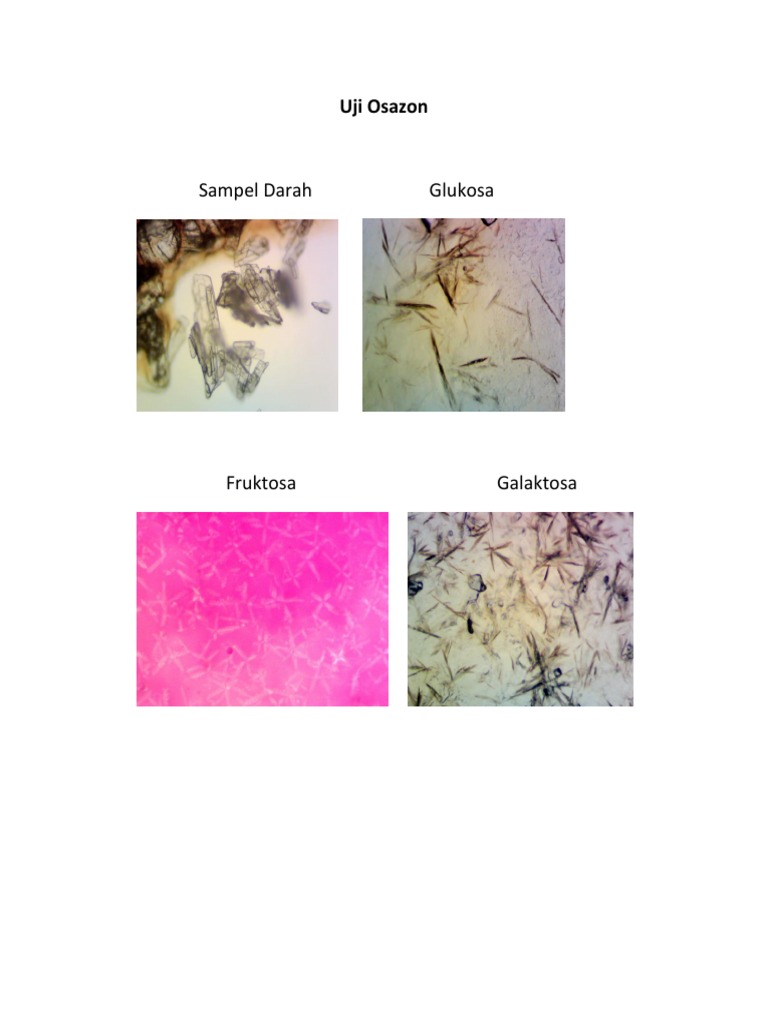 Uji Osazon | PDF