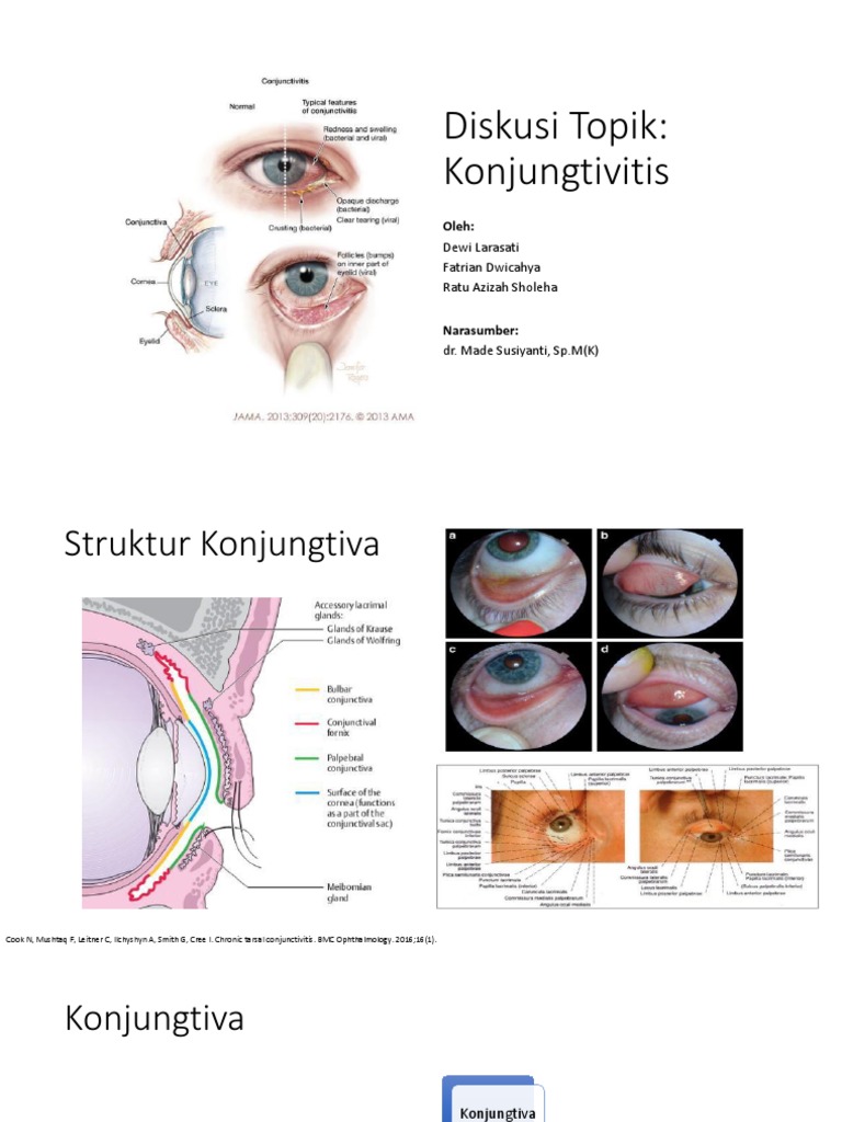 Konjungtivitis | PDF
