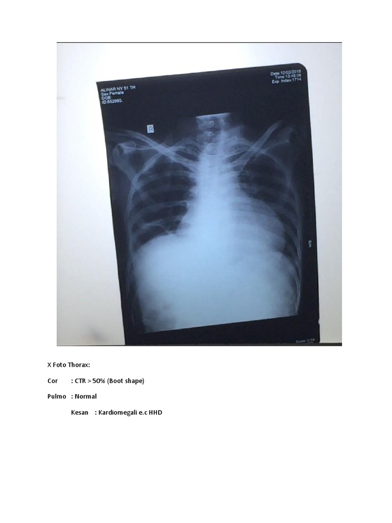 Rontgen | PDF