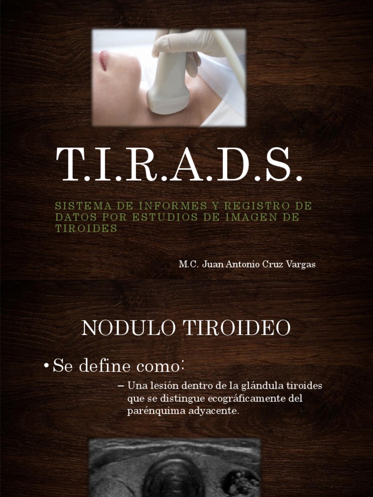 Expo Tirads | PDF | Medicina | Especialidades Medicas