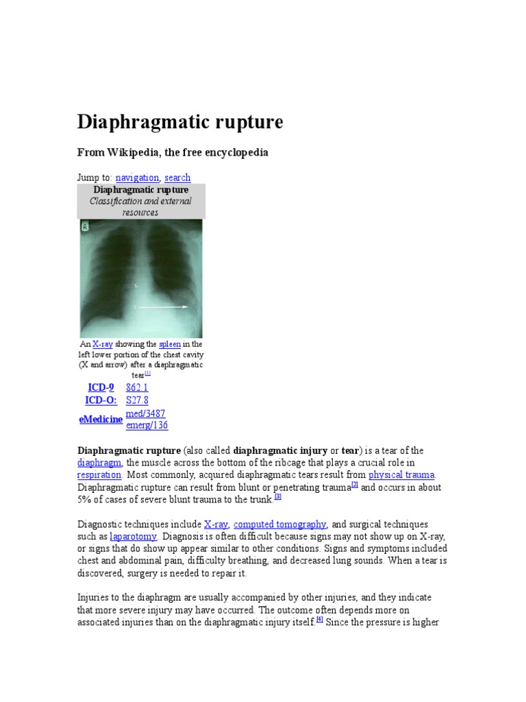 Ruptur Diafragma Wikipedia | PDF | Clinical Medicine | Medical Specialties
