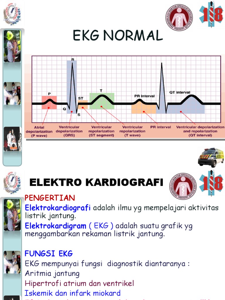 Panduan EKG Normal dan Fungsinya | PDF