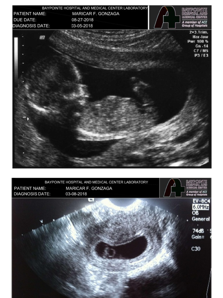 Ultrasound | PDF