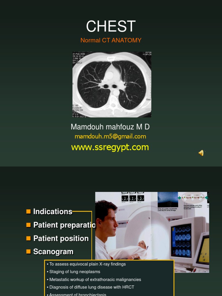 Normal CT Chest | Download Free PDF | Ct Scan | Diseases And Disorders