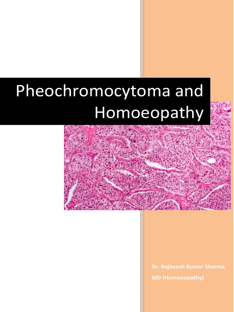 Pheochromocytoma and Homoeopathy | PDF | Animal Anatomy | Organ (Anatomy)