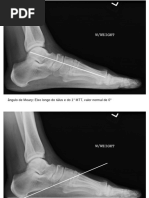 11 - Região Poplítea | PDF | Joelho | Anatomia humana