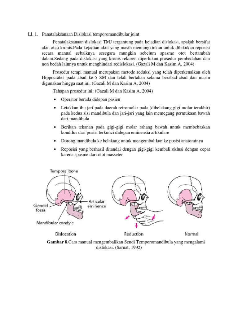 Penatalaksanaan Dislokasi TMJ | PDF