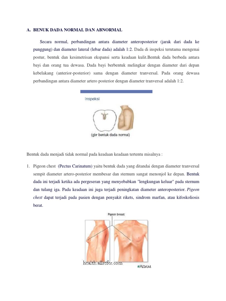 Bentuk Dada Normal Dan Abnormal | PDF