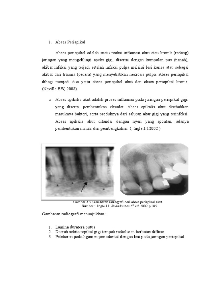 Abses Periapikal Dan Abses Submandibula | PDF