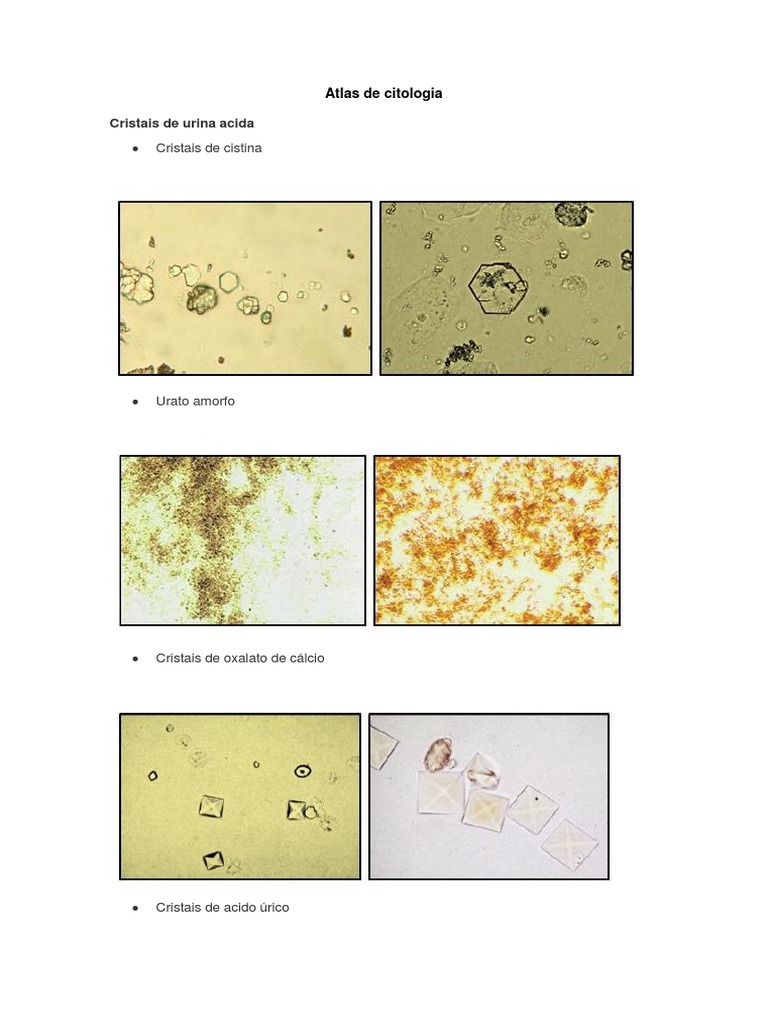 Atlas Citologia - Urina Acida e Alcalina