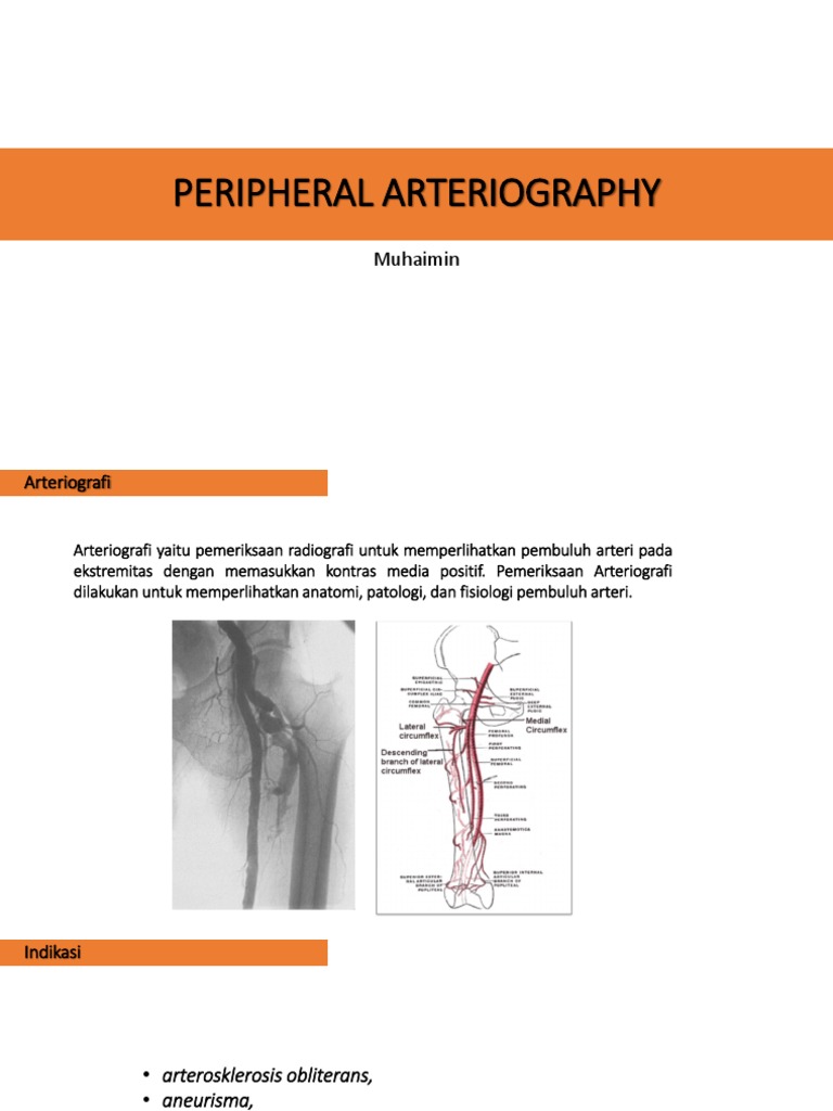 Peripheral Arteriography | PDF