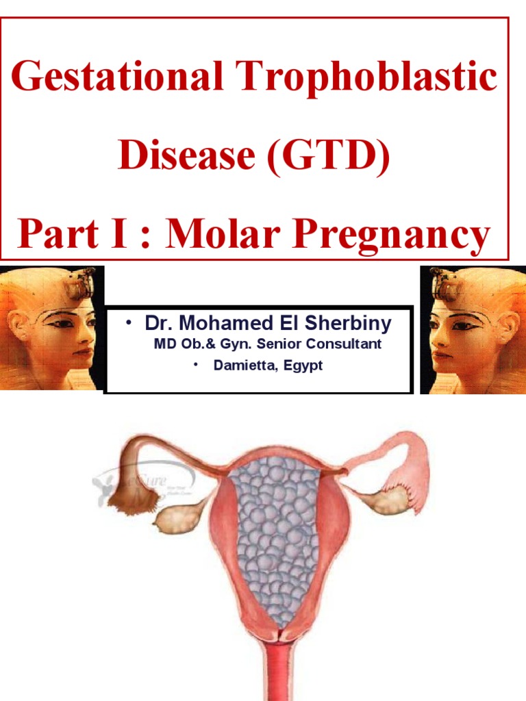 Kehamilan Mola | PDF | Human Reproduction | Women's Health