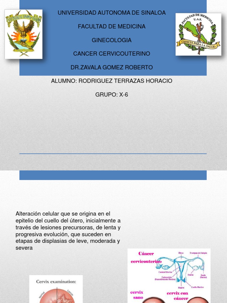 14 Cacu | PDF | Cáncer de cuello uterino | Cáncer
