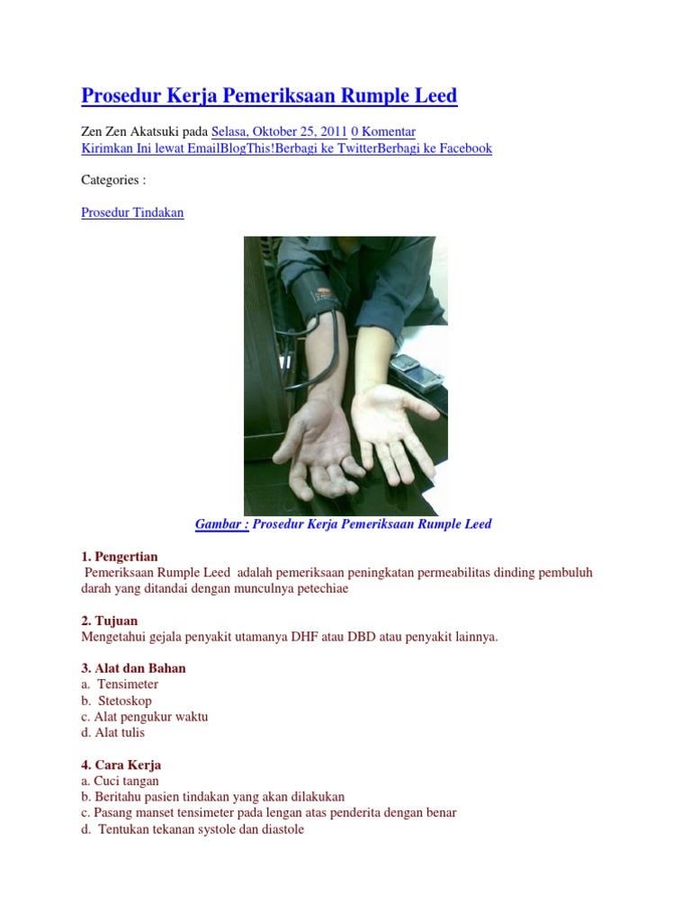 Prosedur Kerja Pemeriksaan Rumple Leed | PDF