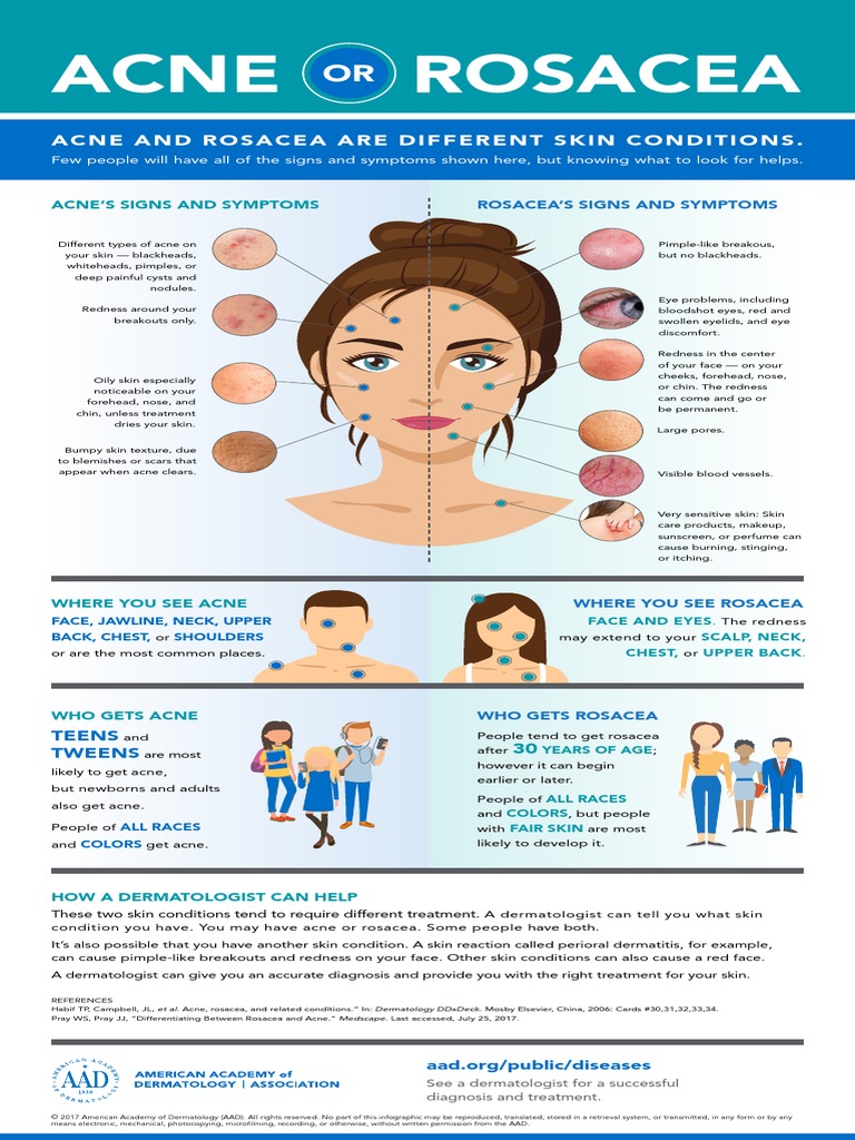 Acne or Rosacea Infographic PDF | PDF | Dermatology | Cutaneous Conditions