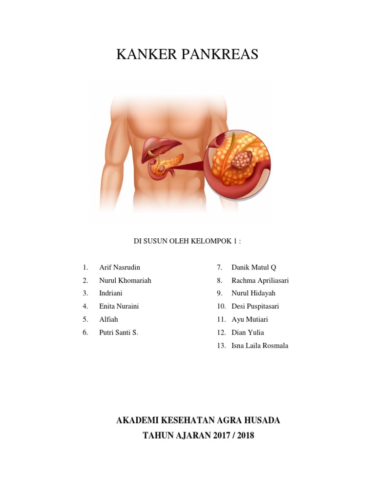 Kanker Pankreas Pdf