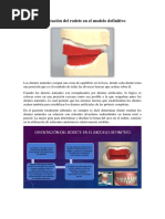 Orientación Del Rodete en El Modelo Definitivo