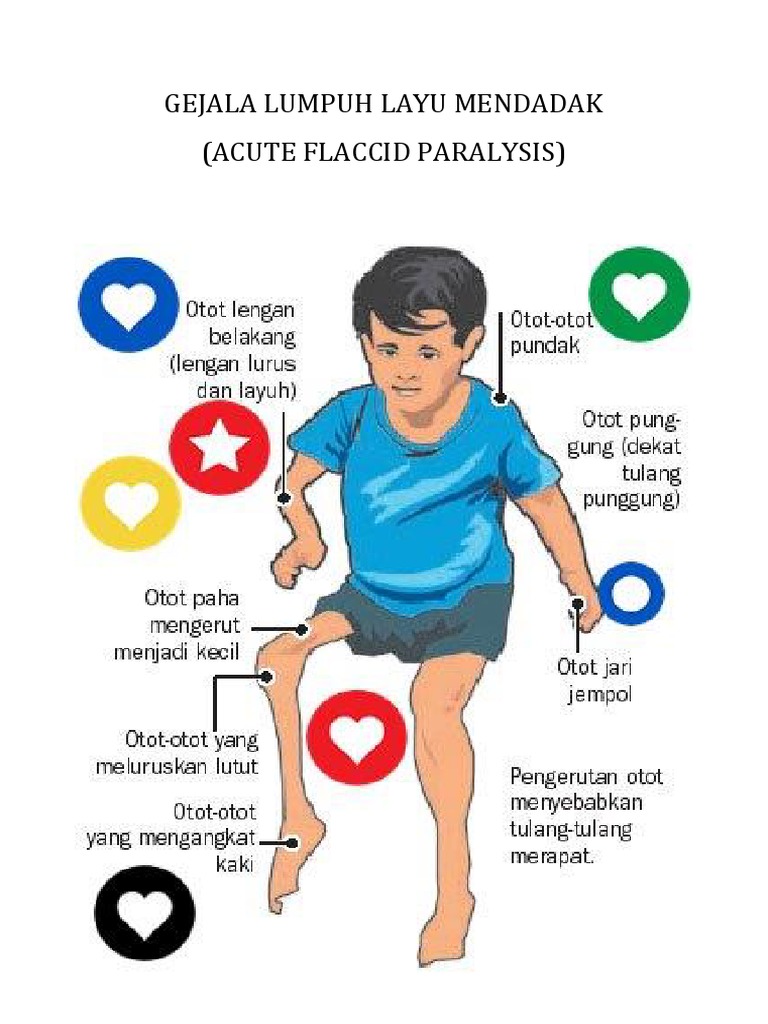 Gejala Lumpuh Layu Mendadak | PDF