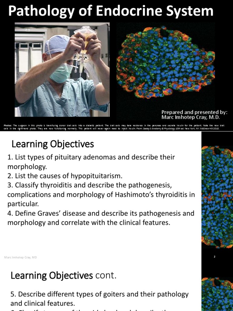 Endocrine System Pathology PPT Lecture Series | PDF ...